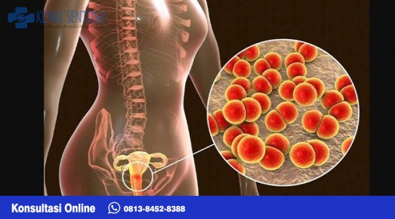 Gejala dan Penyebab Gonore yang Jarang Disadari