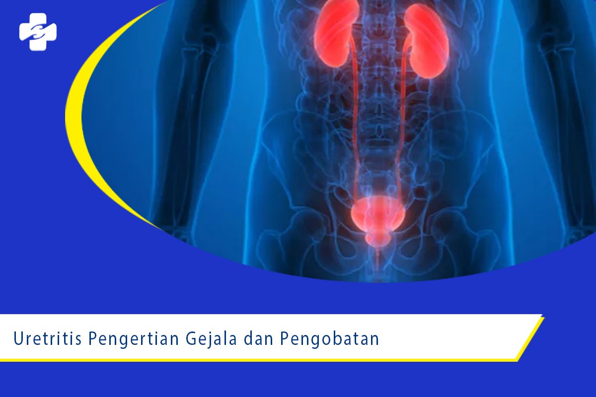 Uretritis: Penyebab, Gejala, Pencegahan dan Pengobatan