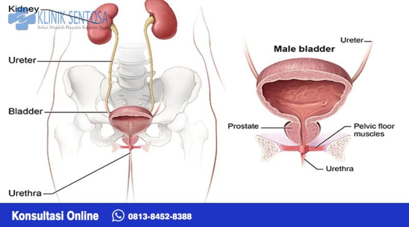 Berbagai Macam Penyebab Infeksi Saluran Kemih Pada Pria