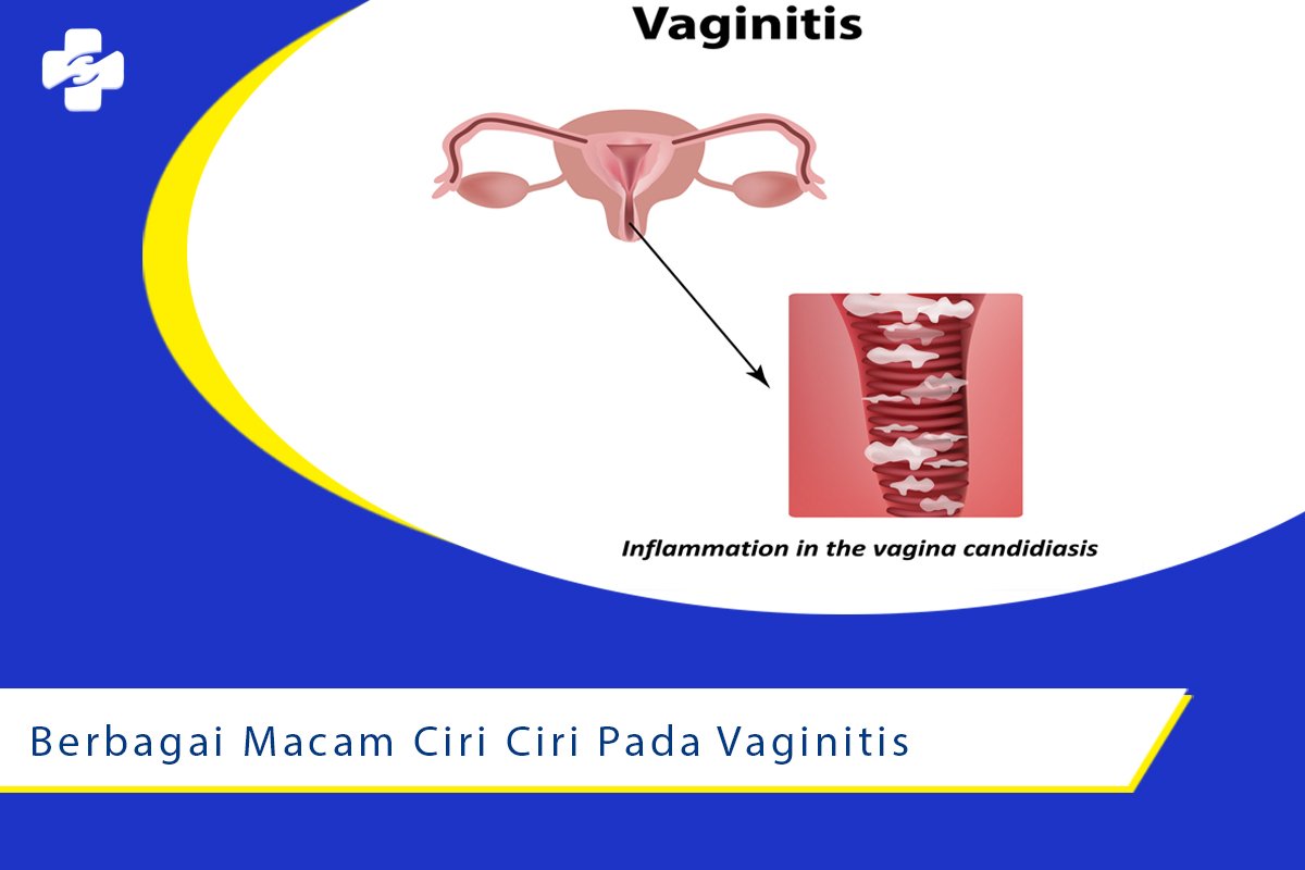 7 Penyebab Gatal Pada Kemaluan Perempuan