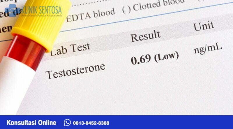 Cek Biaya Pemeriksaan Tes Impotensi | Klinik Utama Apollo