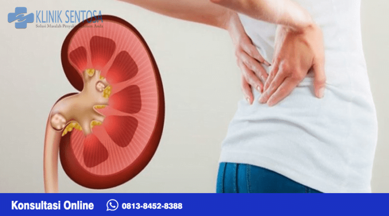 Cara Mengatasi Sakit Kencing pada Wanita | Klinik Utama Apollo