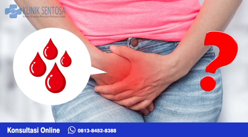 Ketahui Penyebab Kencing Berdarah Pada Wanita | Klinik Utama Apollo