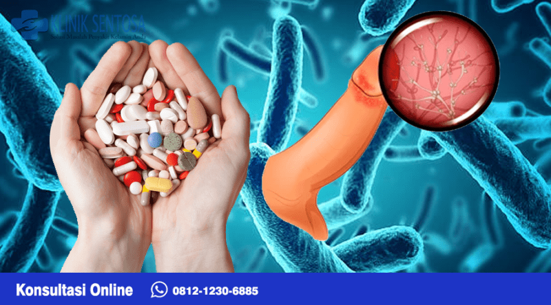 Metode Pengobatan Balanitis Terbaik di Jakarta | Klinik Utama Apollo