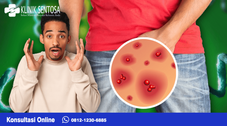 Waspadai Gejala Awal Sifilis pada Pria! | Klinik Utama Apollo