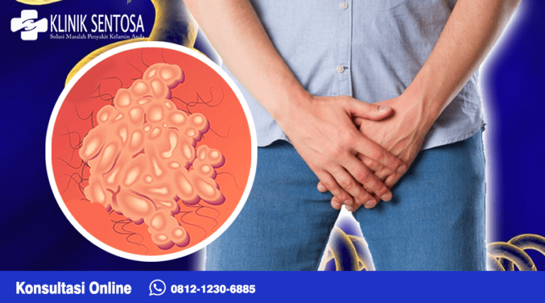 Mari Cari Tahu Tanda Sifilis pada Pria! | Klinik Utama Apollo
