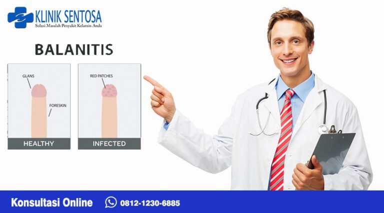 Dokter Balanitis Daerah Jakarta Utara | Klinik Utama Apollo