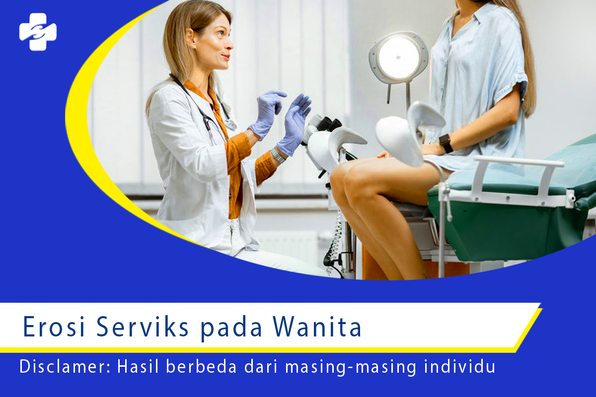 Gangguan Erosi Serviks pada Wanita | Klinik Utama Sentosa