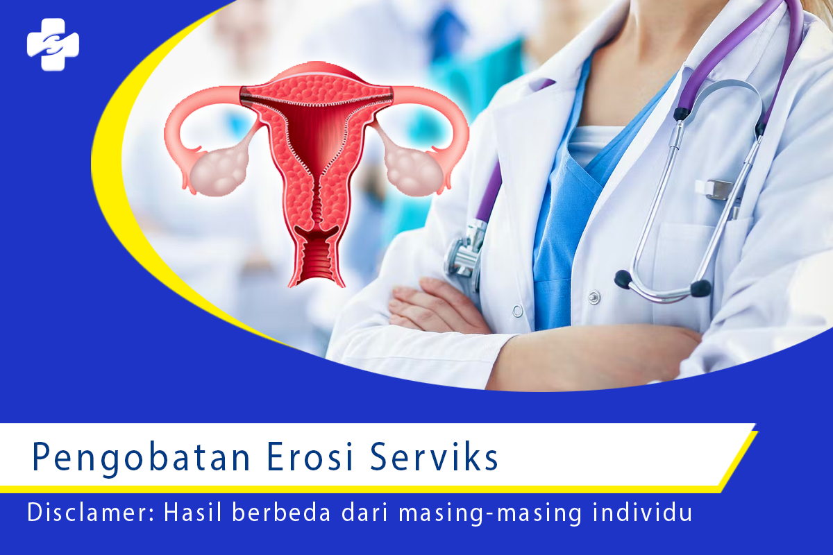 Pengobatan Erosi Serviks Di Klinik Terdekat | Klinik Utama Sentosa