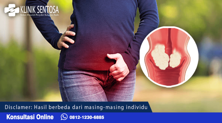 Metode Pengobatan Erosi Serviks di Klinik | Klinik Utama Sentosa