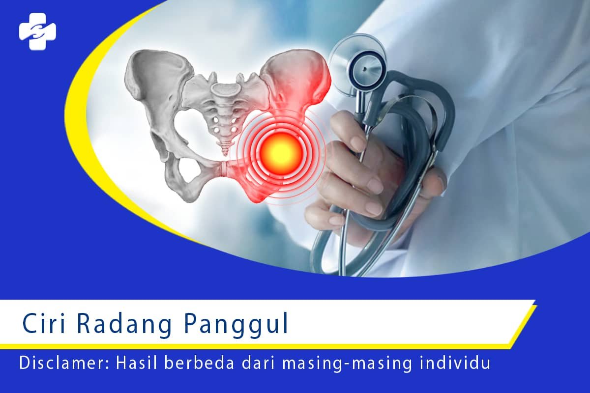 Benarkah PID Berbahaya? Mari Ketahui Ciri Radang Panggul