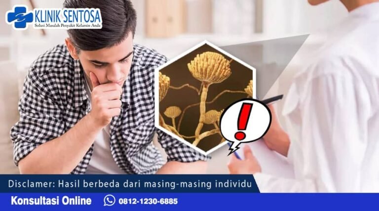 Infeksi Balanitis Jamur, Waspada para Pria! | Klinik Utama Sentosa