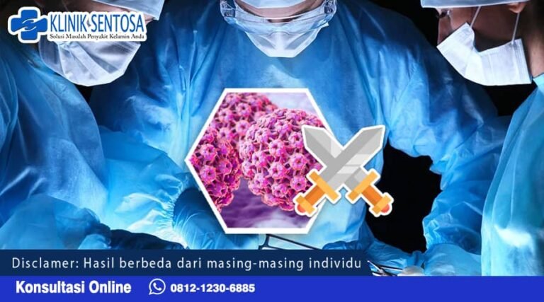 Keunggulan Laser Kutil Kelamin, Pasti Aman? | Klinik Utama Apollo