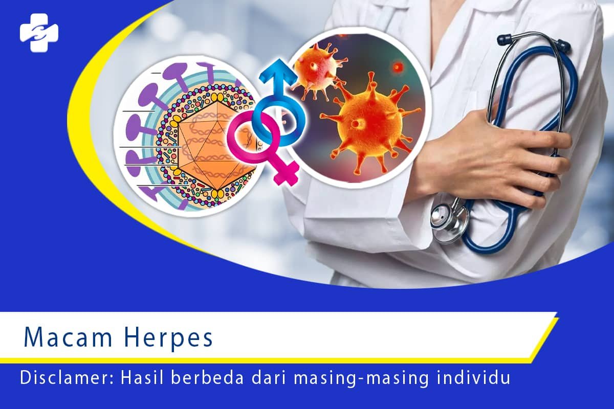 Membedakan Macam Herpes: Genitalis dan Zoster | Klinik Utama Apollo