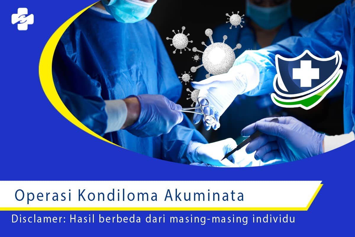 Perbandingan Metode Operasi Kondiloma Akuminata | Klinik Utama Apollo
