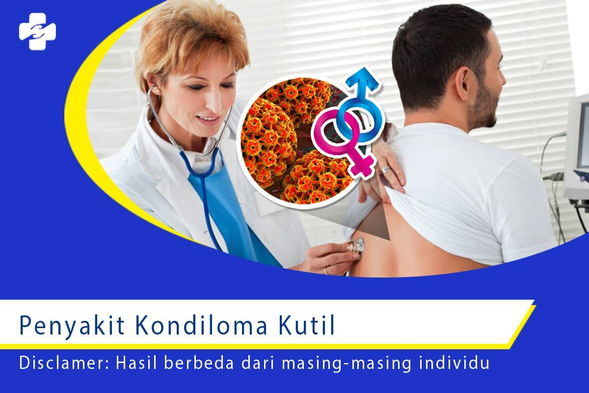 Kaitan Penyakit Kondiloma Kutil dan Kanker Serviks | Klinik Utama Sentosa