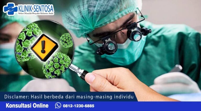 Kutil Kelamin Hilang dengan Prosedur Krioterapi | Klinik Utama Apollo