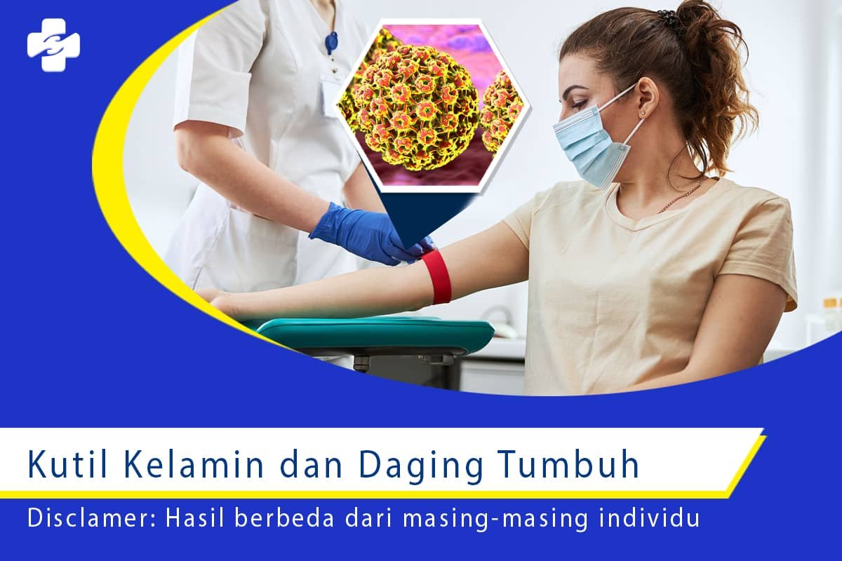 Kutil Kelamin dan Daging Tumbuh, Coba Bedakan! | Klinik Utama Sentosa