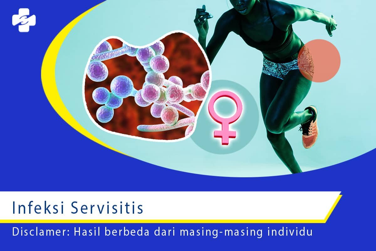 Infeksi Servisitis, Waspada Para Wanita! | Klinik Utama Apollo