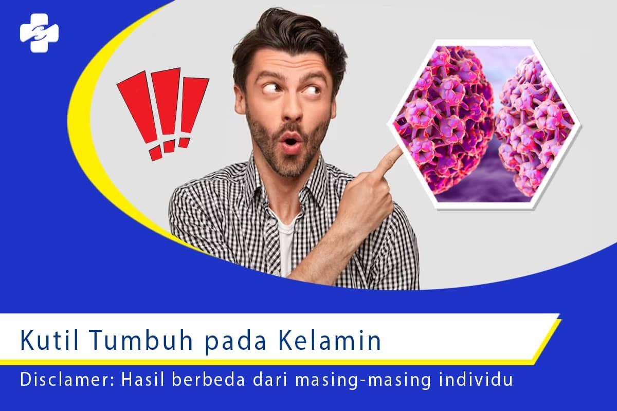 Kutil Tumbuh pada Kelamin, Bisa Picu Sensasi Gatal! | Klinik Utama Sentosa