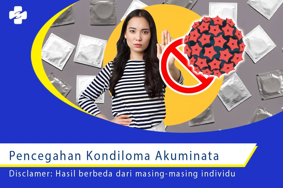 Pencegahan Kondiloma Akuminata pada Remaja | Klinik Utama Apollo