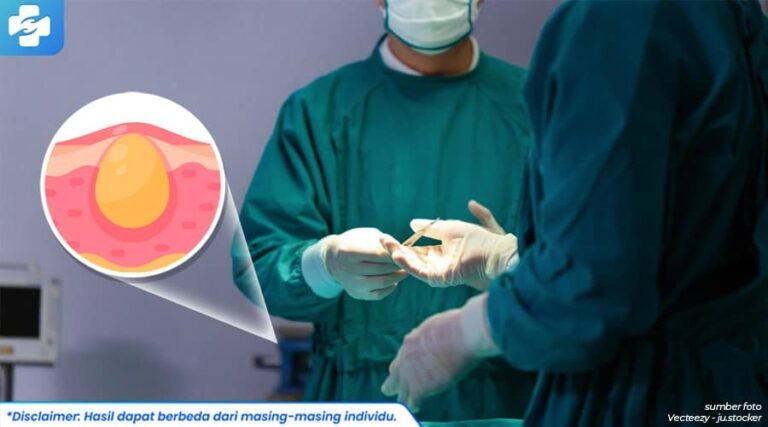 5 Penyebab Munculnya Bisul di Miss V yang Mengganggu, Catat! | Klinik ...